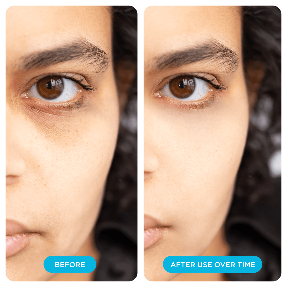 Topicals - NIGHT Under Eye Patch